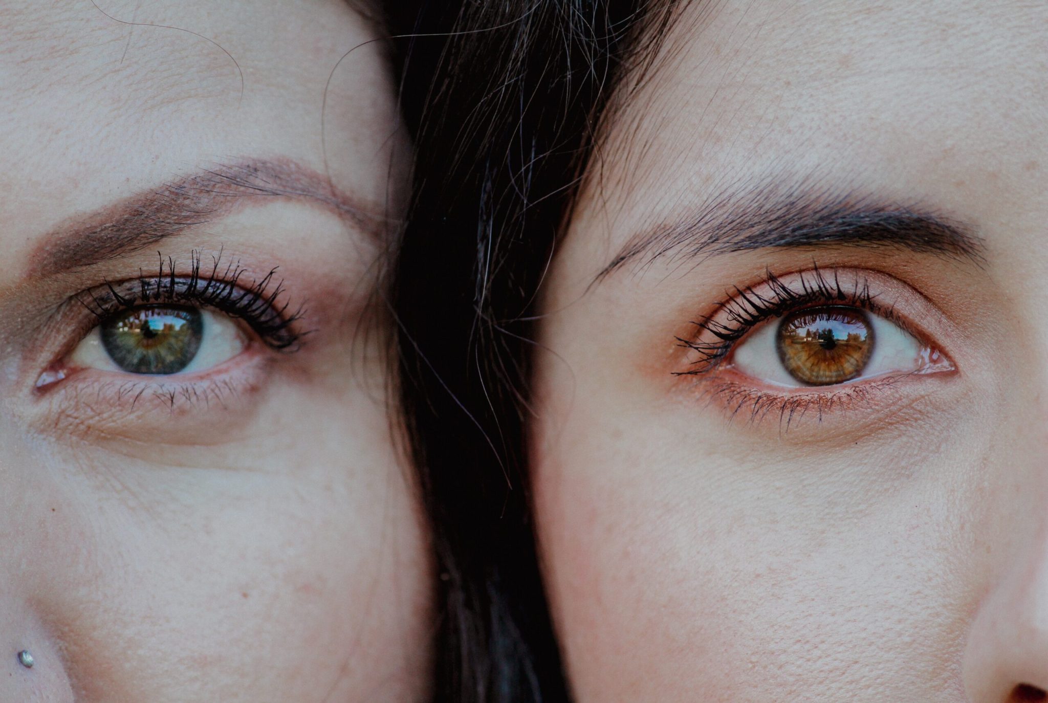 What can I do about sagging skin under eyes?