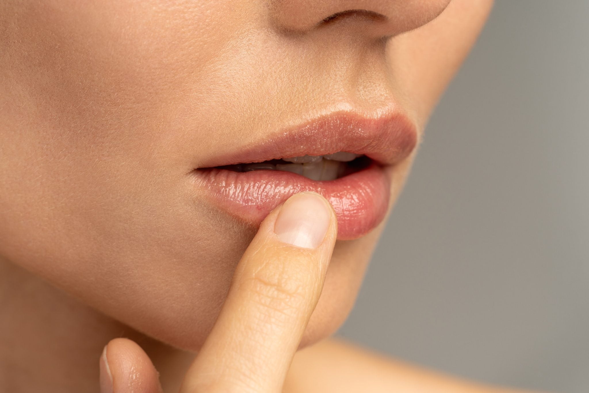 Bruising After Lip Filler: What to Expect and How to Minimise Discomfort