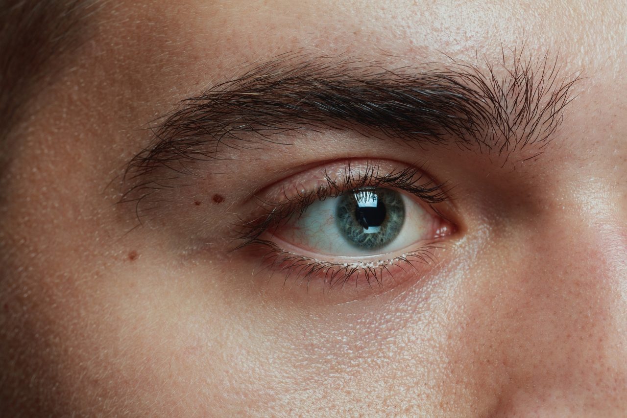 Droopy eyelid, or ptosis - definition and treatment