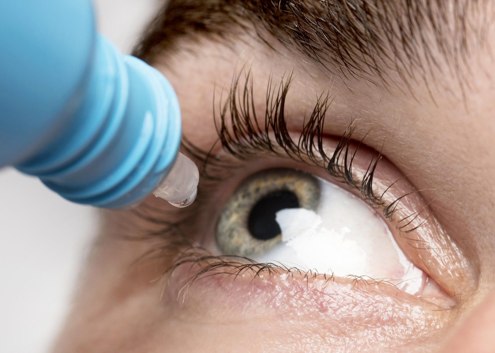 Why Does My Eye Keep Twitching? A Comprehensive Guide to Eyelid Myokymia