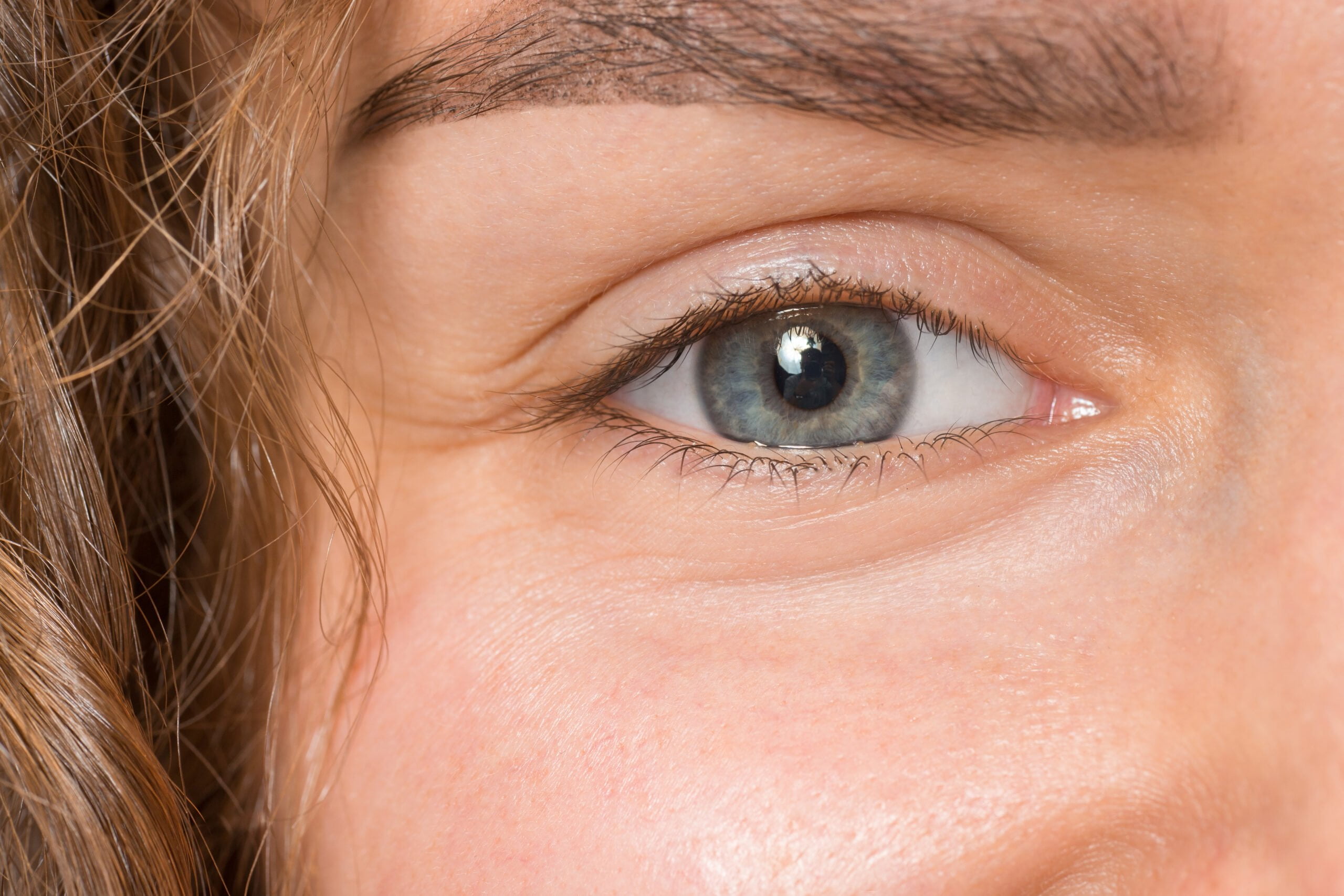 Watery Eyes Treatment