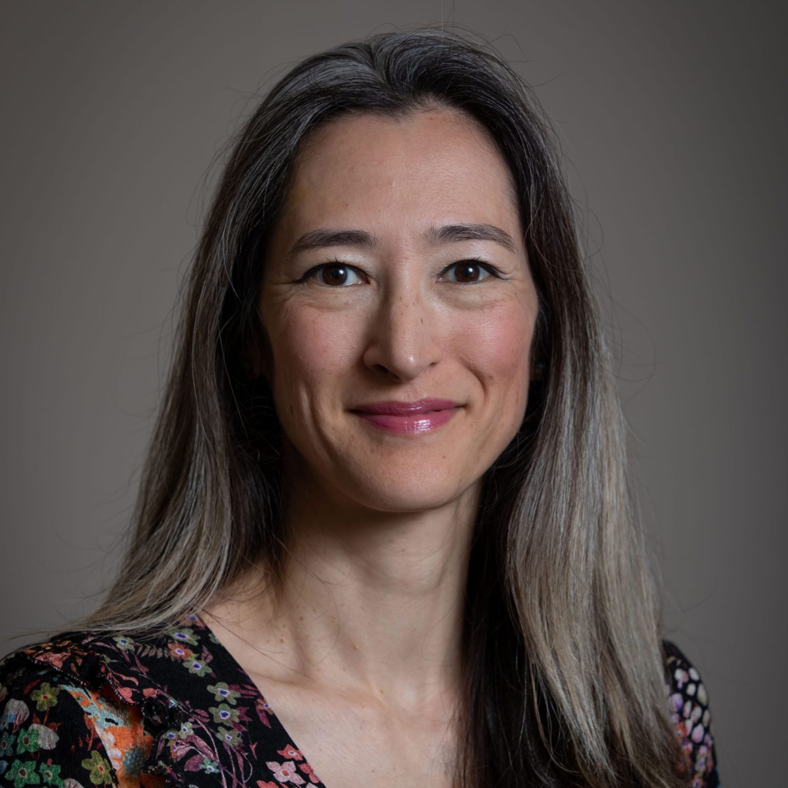 Tessa Fayers oculoplastic surgeon