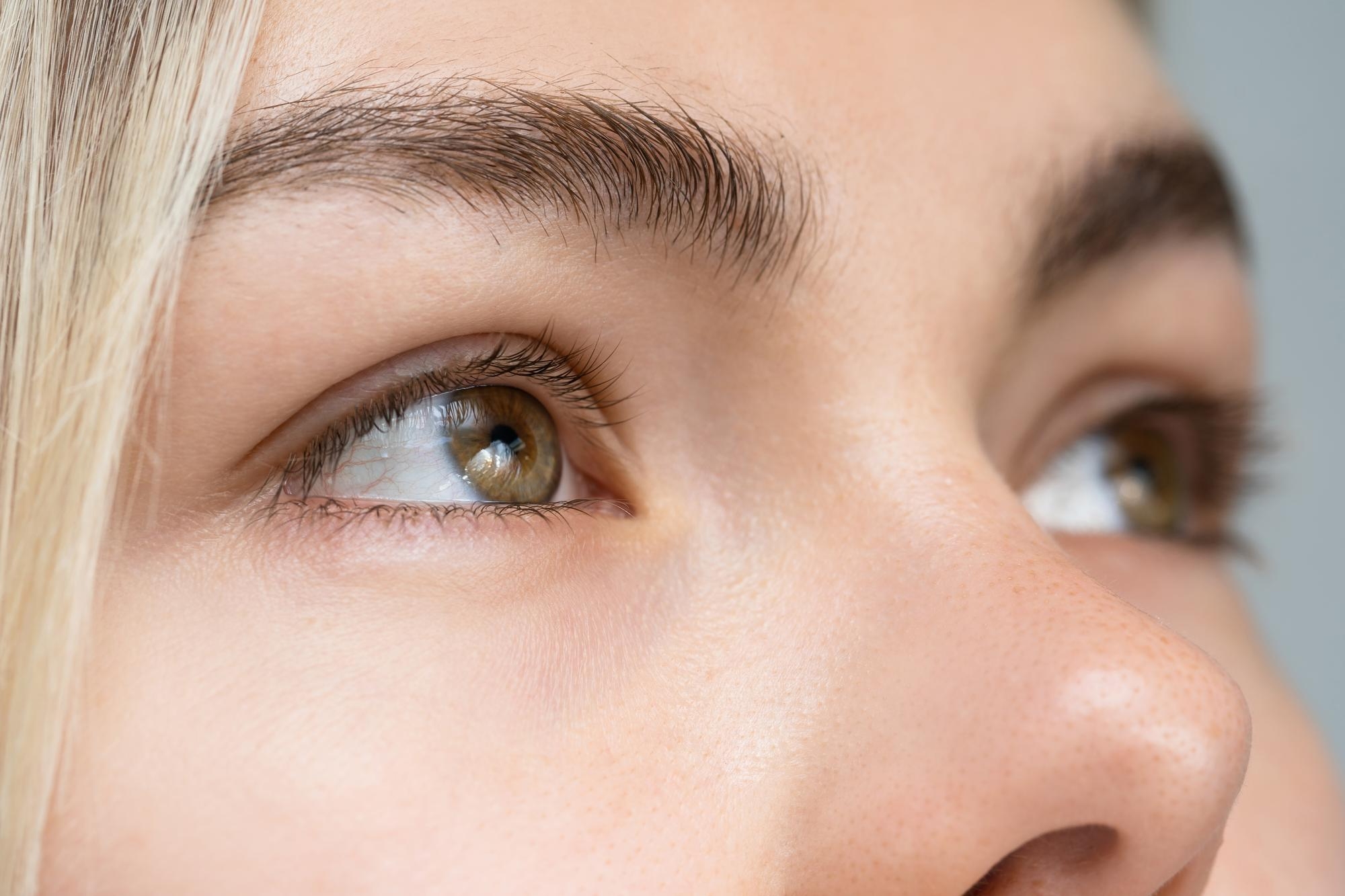 How To Get Rid of Under-Eye Bags Permanently Without Surgery